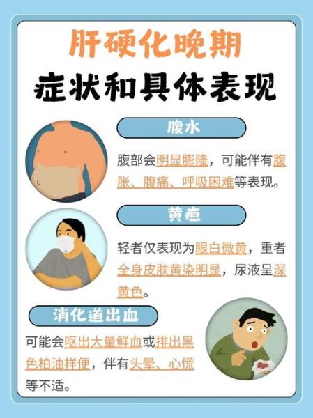 肝硬化能活多久_肝硬化晚期症状有哪些-第1张图片-山城妙识