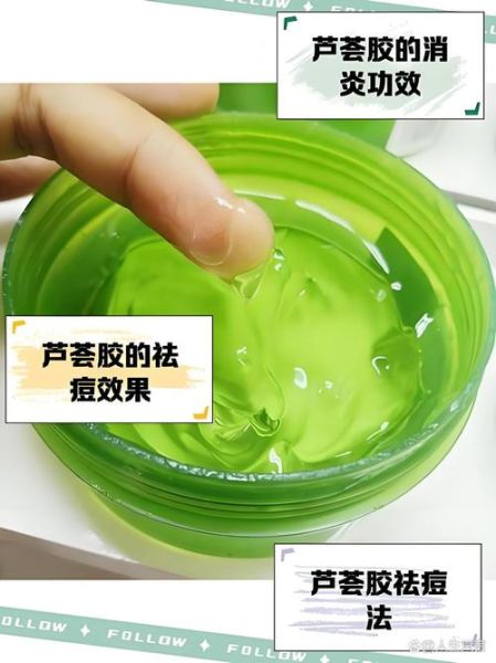 芦荟胶祛痘怎么用_芦荟胶祛痘正确步骤-第3张图片-山城妙识