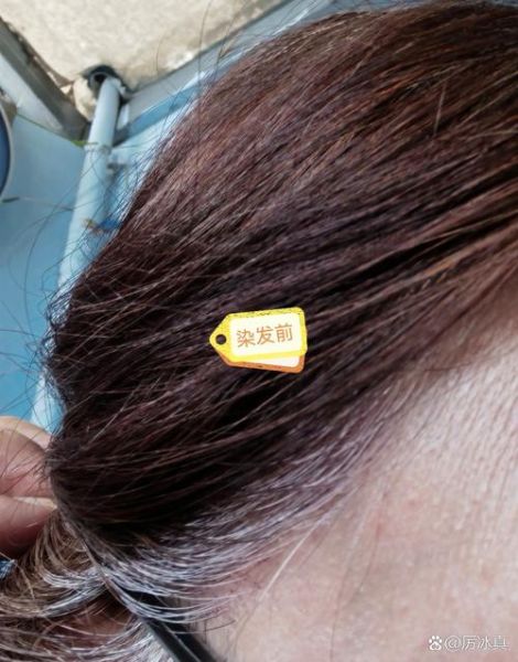 长期吃桑葚白头发能黑吗_桑葚黑发真相-第1张图片-山城妙识