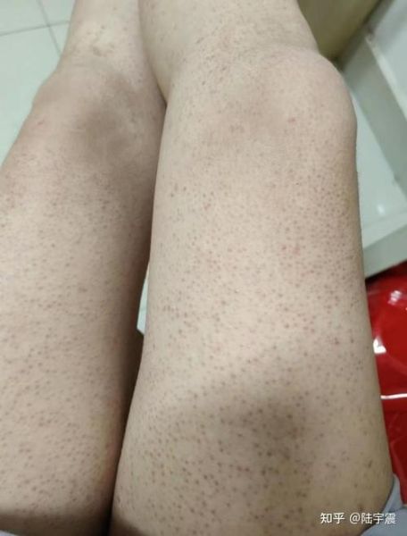 鸡皮肤是什么样子_鸡皮肤图片特征解析-第3张图片-山城妙识 鸡皮肤是什么样子_鸡皮肤图片特征解析-第3张图片-山城妙识