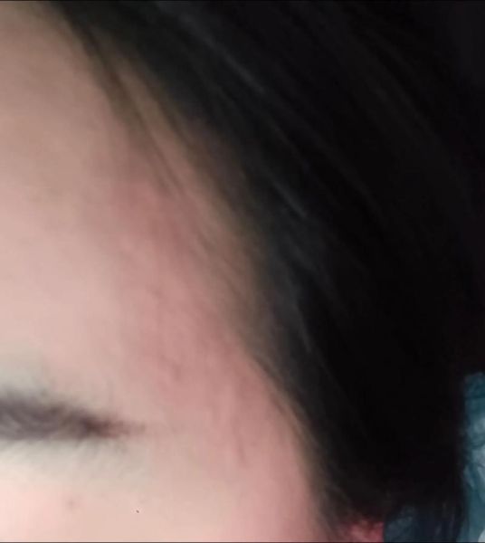 蚕豆过敏症状_蚕豆病能吃蚕豆吗-第1张图片-山城妙识 蚕豆过敏症状_蚕豆病能吃蚕豆吗-第1张图片-山城妙识