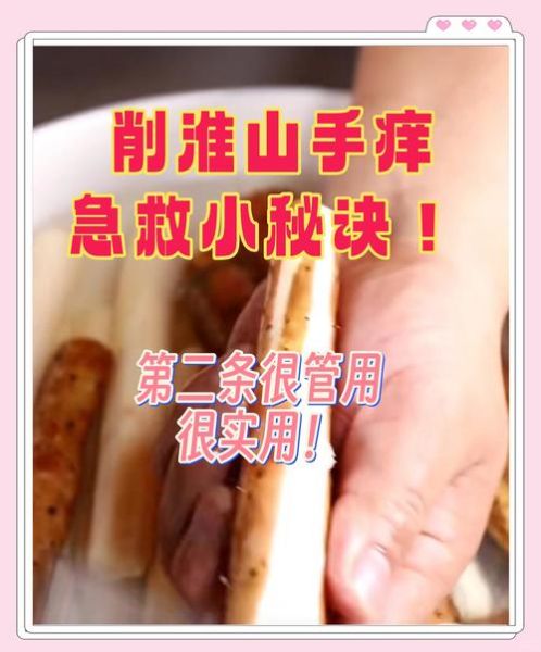 弄完山药手痒怎么办_山药痒快速止痒方法-第1张图片-山城妙识