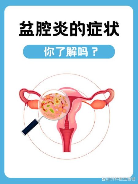 盆腔炎最明显的两个症状是什么_盆腔炎会自己好吗-第2张图片-山城妙识