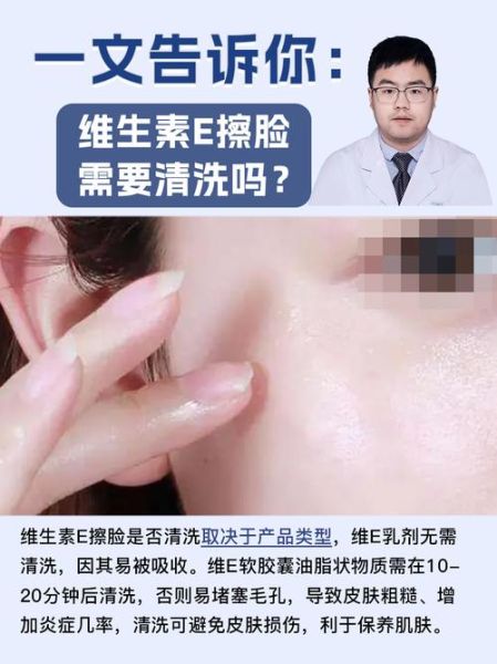 维生素e擦脸有什么副作用_用维生素e擦脸会烂脸吗-第1张图片-山城妙识