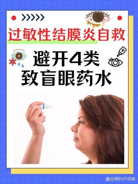过敏性结膜炎症状有哪些_如何快速缓解眼睛痒-第1张图片-山城妙识
