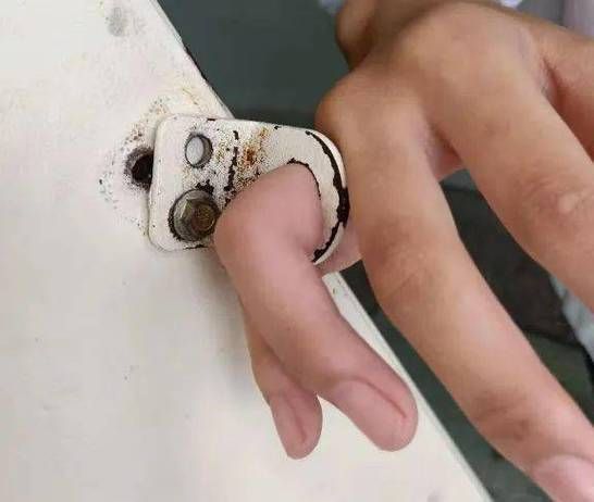 空手指图片是什么_空手指图片怎么去除-第1张图片-山城妙识 空手指图片是什么_空手指图片怎么去除-第1张图片-山城妙识