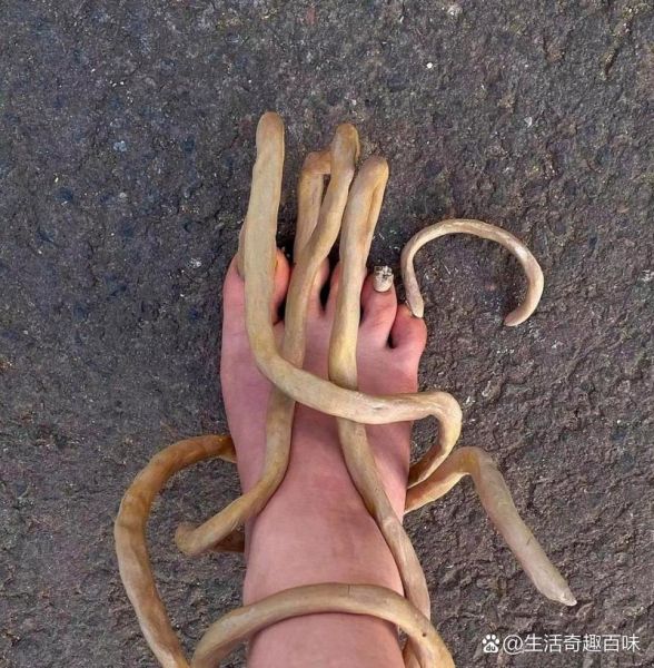 空手指图片是什么_空手指图片怎么去除-第3张图片-山城妙识 空手指图片是什么_空手指图片怎么去除-第3张图片-山城妙识