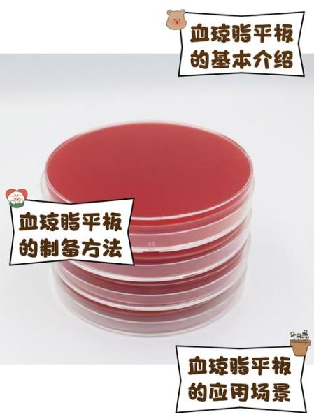 营养琼脂平板怎么保存_营养琼脂平板有效期多久-第1张图片-山城妙识