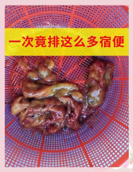 酵素吃出黑肠子_黑肠子真相-第3张图片-山城妙识