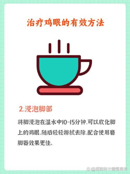 鸡眼怎么去除最好方法_鸡眼贴有用吗-第3张图片-山城妙识 鸡眼怎么去除最好方法_鸡眼贴有用吗-第3张图片-山城妙识