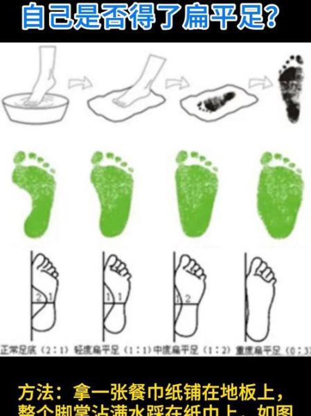 马蹄脚是什么_马蹄脚图片怎么判断-第1张图片-山城妙识 马蹄脚是什么_马蹄脚图片怎么判断-第1张图片-山城妙识