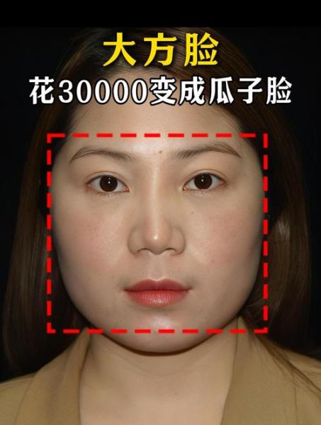 大饼脸怎么能瘦成瓜子脸_有效方法有哪些-第2张图片-山城妙识