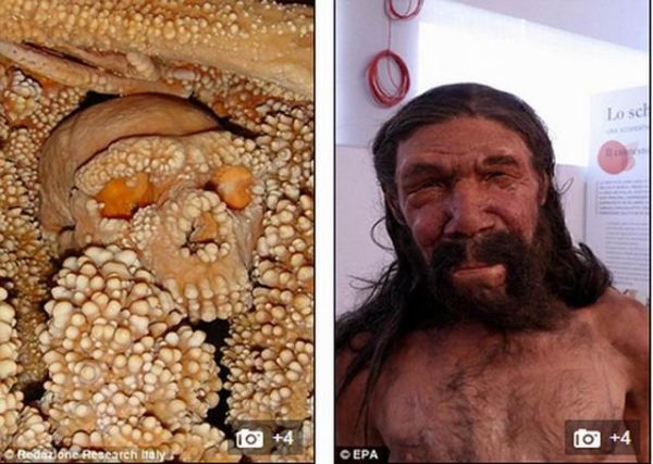 莲蓬乳是什么病_莲蓬乳照片真实吗-第1张图片-山城妙识