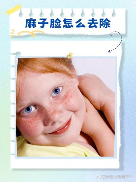 麻子脸怎么去除_麻子脸图片对比效果-第1张图片-山城妙识 麻子脸怎么去除_麻子脸图片对比效果-第1张图片-山城妙识