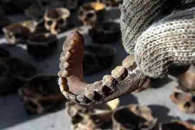 莲蓬乳图片空手指_是什么心理现象-第2张图片-山城妙识