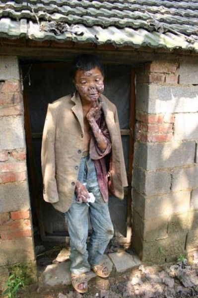 莲蓬乳图片空手指_是什么心理现象-第1张图片-山城妙识