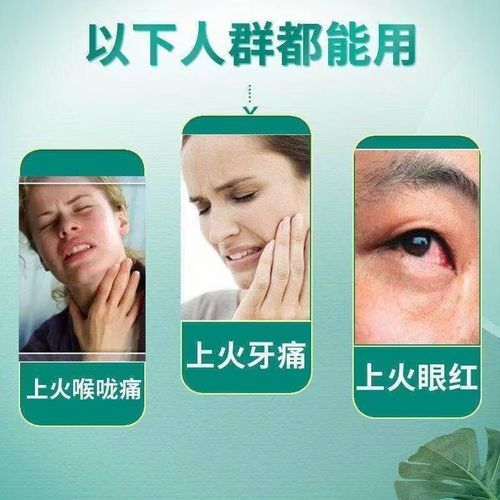 败火的药有哪些_败火的药怎么选-第1张图片-山城妙识 败火的药有哪些_败火的药怎么选-第1张图片-山城妙识