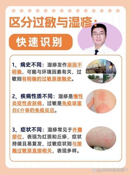 过敏和湿疹的区别图片_如何一眼分辨-第1张图片-山城妙识