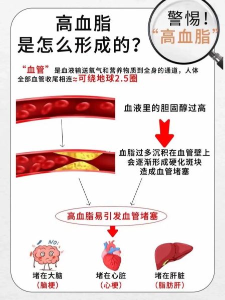 血脂稠的症状有哪些_血脂稠的危害是什么-第2张图片-山城妙识