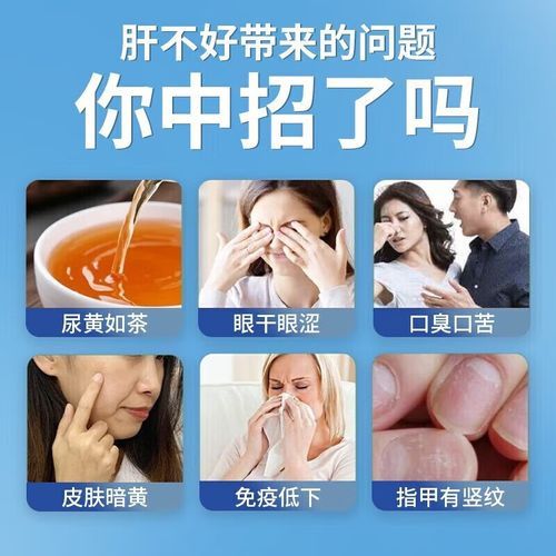 肝胆湿热吃什么药效果最好_肝胆湿热中成药推荐-第1张图片-山城妙识 肝胆湿热吃什么药效果最好_肝胆湿热中成药推荐-第1张图片-山城妙识