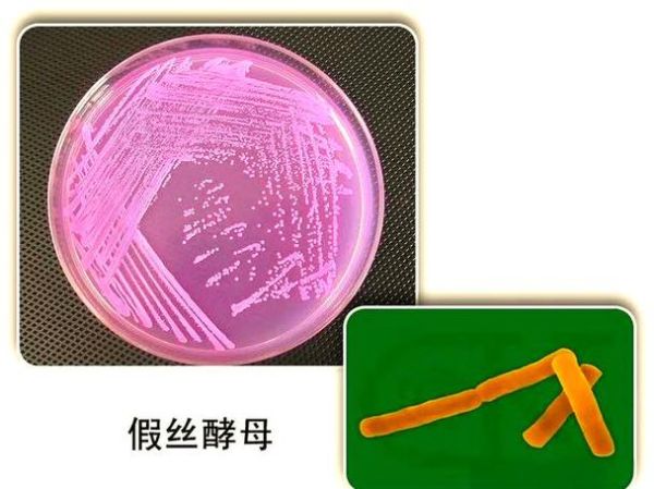 酵母菌如何繁殖_酵母菌繁殖方式有哪些-第3张图片-山城妙识 酵母菌如何繁殖_酵母菌繁殖方式有哪些-第3张图片-山城妙识