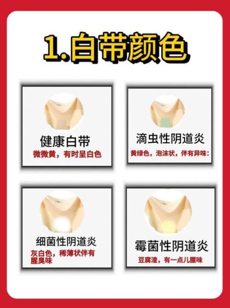 豆腐渣分泌物图片_豆腐渣样白带怎么回事-第2张图片-山城妙识