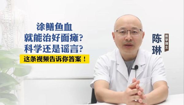 鳝鱼血治疗面瘫的正确方法_鳝鱼血怎么用才有效-第3张图片-山城妙识 鳝鱼血治疗面瘫的正确方法_鳝鱼血怎么用才有效-第3张图片-山城妙识