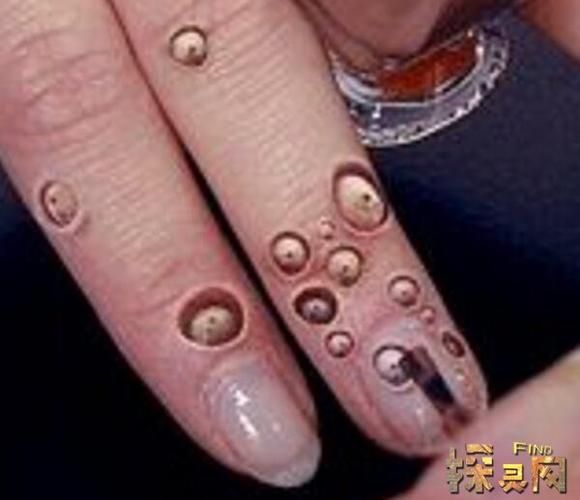 莲蓬手密集恐惧症_怎么克服-第1张图片-山城妙识