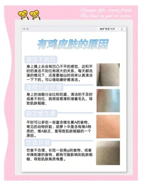 鸡皮肤怎么消除最有效_鸡皮肤用什么药膏最好-第3张图片-山城妙识