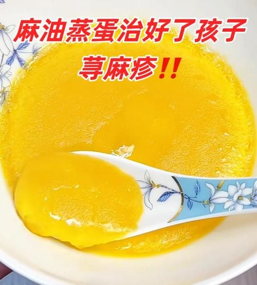 麻油蒸鸡蛋治疗荨麻疹_真的有用吗-第1张图片-山城妙识