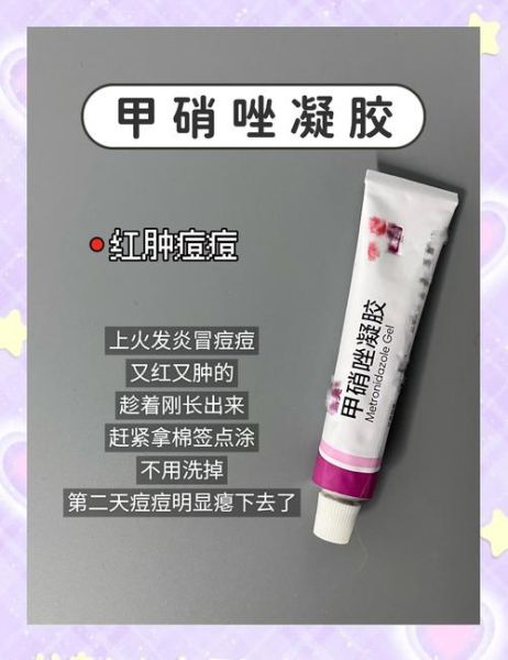 脸上长痘痘怎么调理_脸上长痘痘用什么药膏-第1张图片-山城妙识