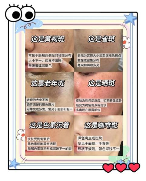 怎样美白淡斑效果最好_最有效的美白淡斑方法-第1张图片-山城妙识 怎样美白淡斑效果最好_最有效的美白淡斑方法-第1张图片-山城妙识