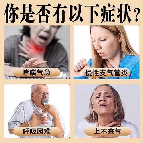 蛤蚧定喘丸适合什么人吃_蛤蚧定喘丸吃多久见效-第1张图片-山城妙识 蛤蚧定喘丸适合什么人吃_蛤蚧定喘丸吃多久见效-第1张图片-山城妙识