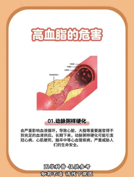 血脂高有什么症状_血脂高身体4个表现-第3张图片-山城妙识 血脂高有什么症状_血脂高身体4个表现-第3张图片-山城妙识