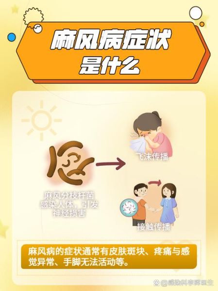 麻风病会传染吗_麻风病早期症状有哪些-第3张图片-山城妙识 麻风病会传染吗_麻风病早期症状有哪些-第3张图片-山城妙识