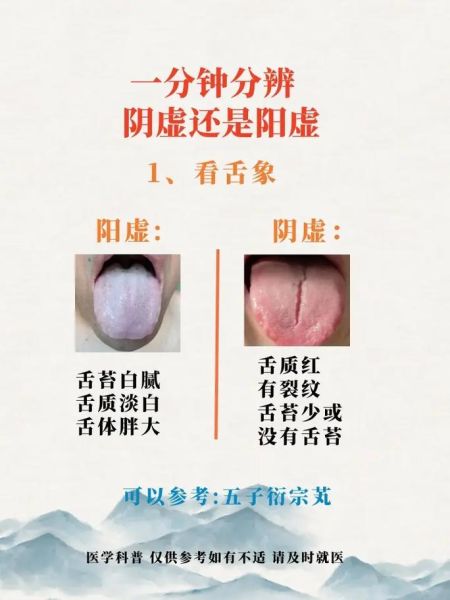 阴虚和阳虚的区别_如何判断自己阴虚还是阳虚-第2张图片-山城妙识