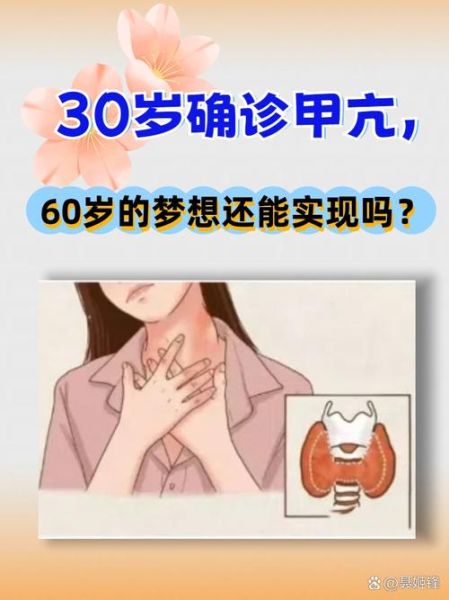 甲亢会影响寿命吗_甲亢患者能活多久-第1张图片-山城妙识
