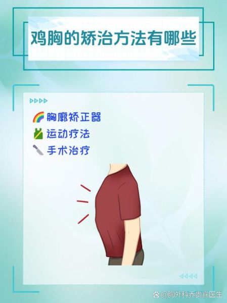 鸡胸图正确对照图_鸡胸矫正动作图解-第1张图片-山城妙识