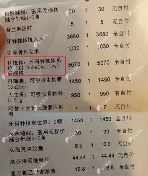 麦芽口腔收费价目表_种植牙多少钱一颗-第3张图片-山城妙识