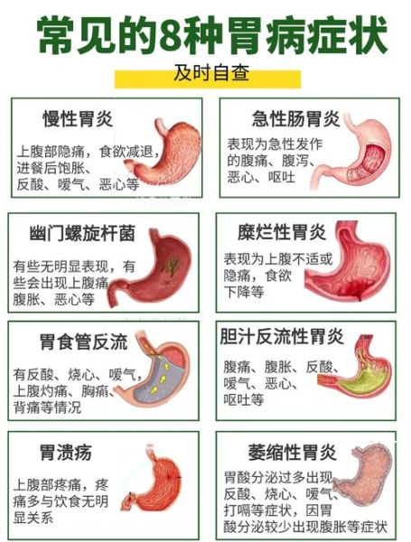 胃病从轻到重有哪些_如何区分胃病严重程度-第1张图片-山城妙识