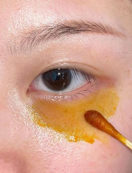 黑眼圈太重怎么消除_黑眼圈怎么快速淡化-第3张图片-山城妙识