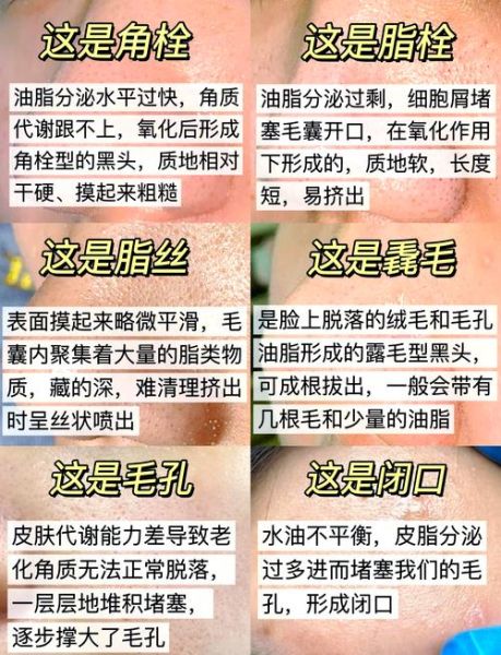 蛋清去黑头真的有用吗_蛋清去黑头步骤-第1张图片-山城妙识