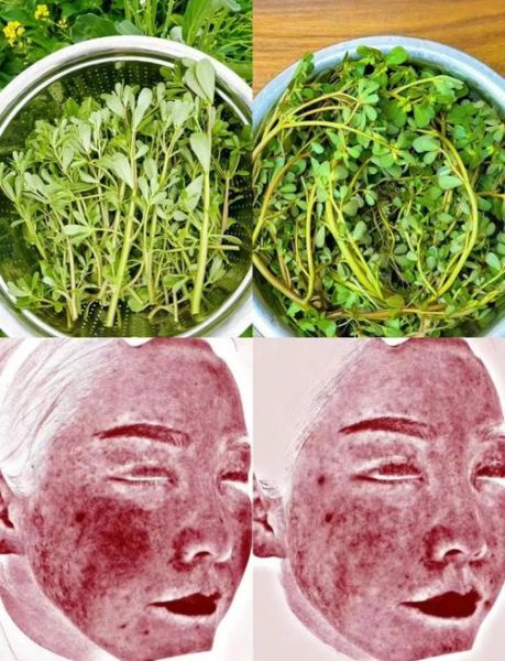 马齿苋敷脸过敏怎么办_马齿苋敷脸越敷越厉害原因-第2张图片-山城妙识 马齿苋敷脸过敏怎么办_马齿苋敷脸越敷越厉害原因-第2张图片-山城妙识