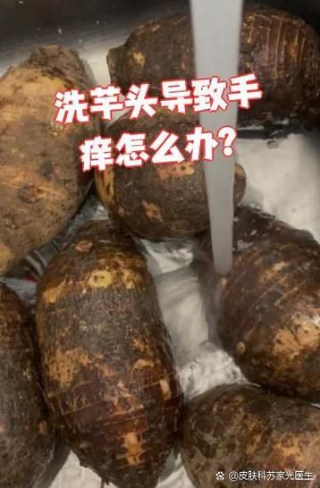 芋头手痒怎么处理_芋头手痒多久能好-第3张图片-山城妙识