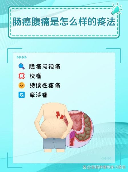 肠癌早期症状有哪些_肠癌早期会腹痛吗-第1张图片-山城妙识
