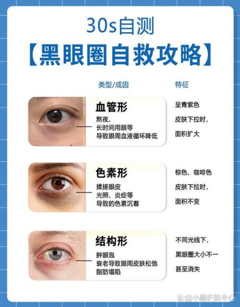 怎么消除黑眼圈_眼袋怎么消除-第1张图片-山城妙识