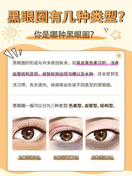 怎么消除黑眼圈_眼袋怎么消除-第2张图片-山城妙识