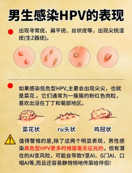 菜花状疙瘩是什么_会传染吗-第2张图片-山城妙识