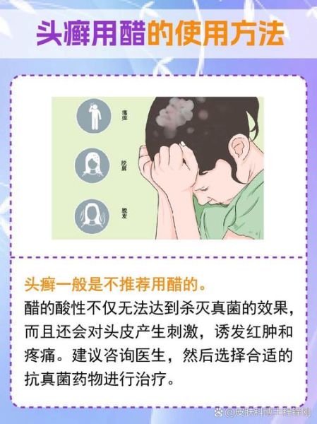 醋能治好皮肤病吗_醋治皮肤病的真实经历-第1张图片-山城妙识