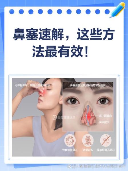 鼻塞怎么办_如何快速通气-第2张图片-山城妙识